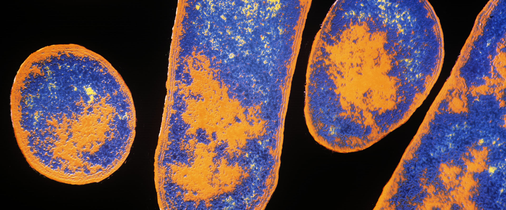 Who Uses Botulinum Toxin and What Are Its Benefits?